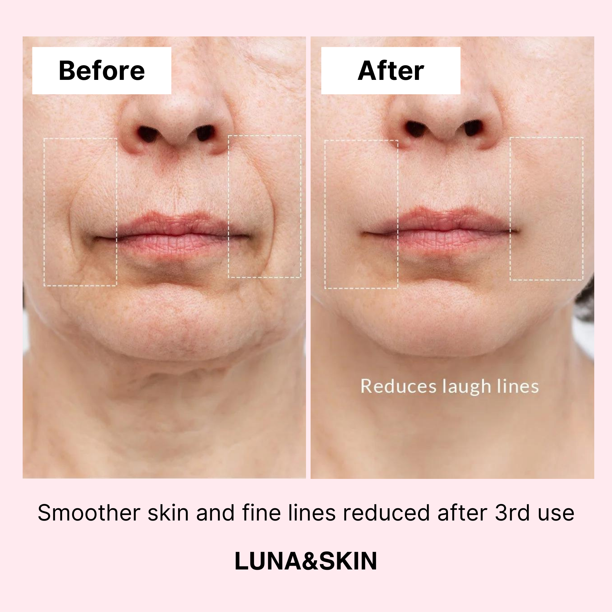 LUNA&SKIN | Your Destination for Beauty Brilliance