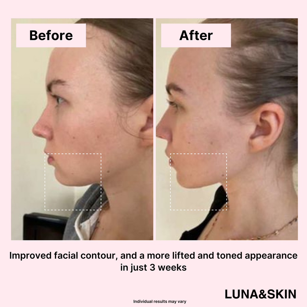 LUNA&SKIN ToneLift™