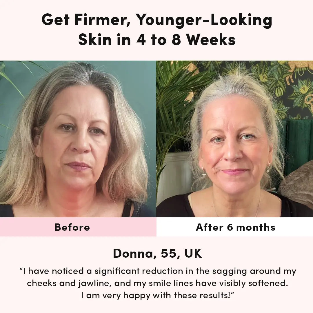 LUNA&SKIN RegenMask™