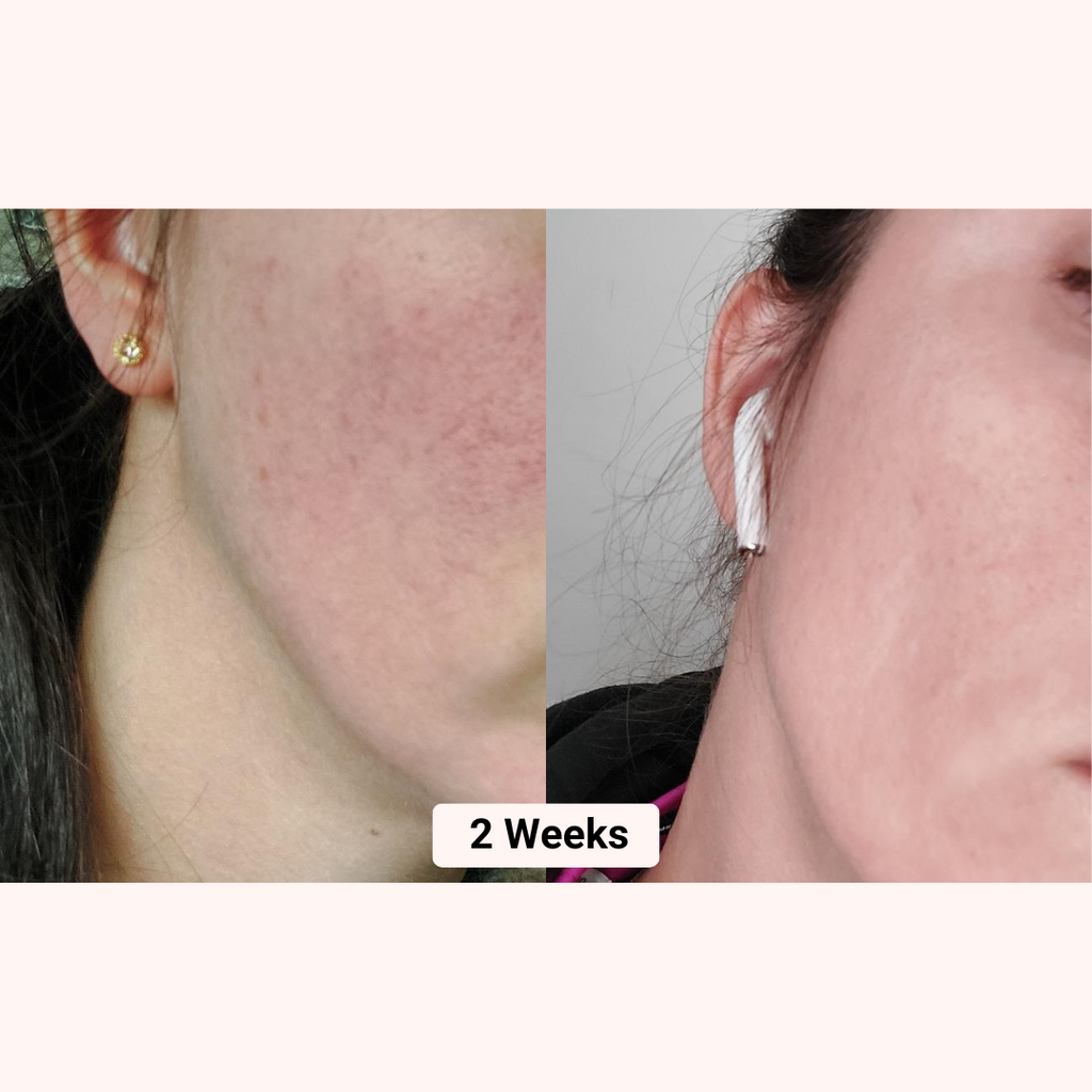 LUNA&SKIN RegenMask™